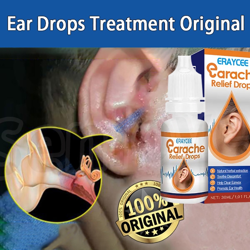 Ear Drops Ear Ringing Relieving Tinnitus Liquid Ear Infection Pruritus ...