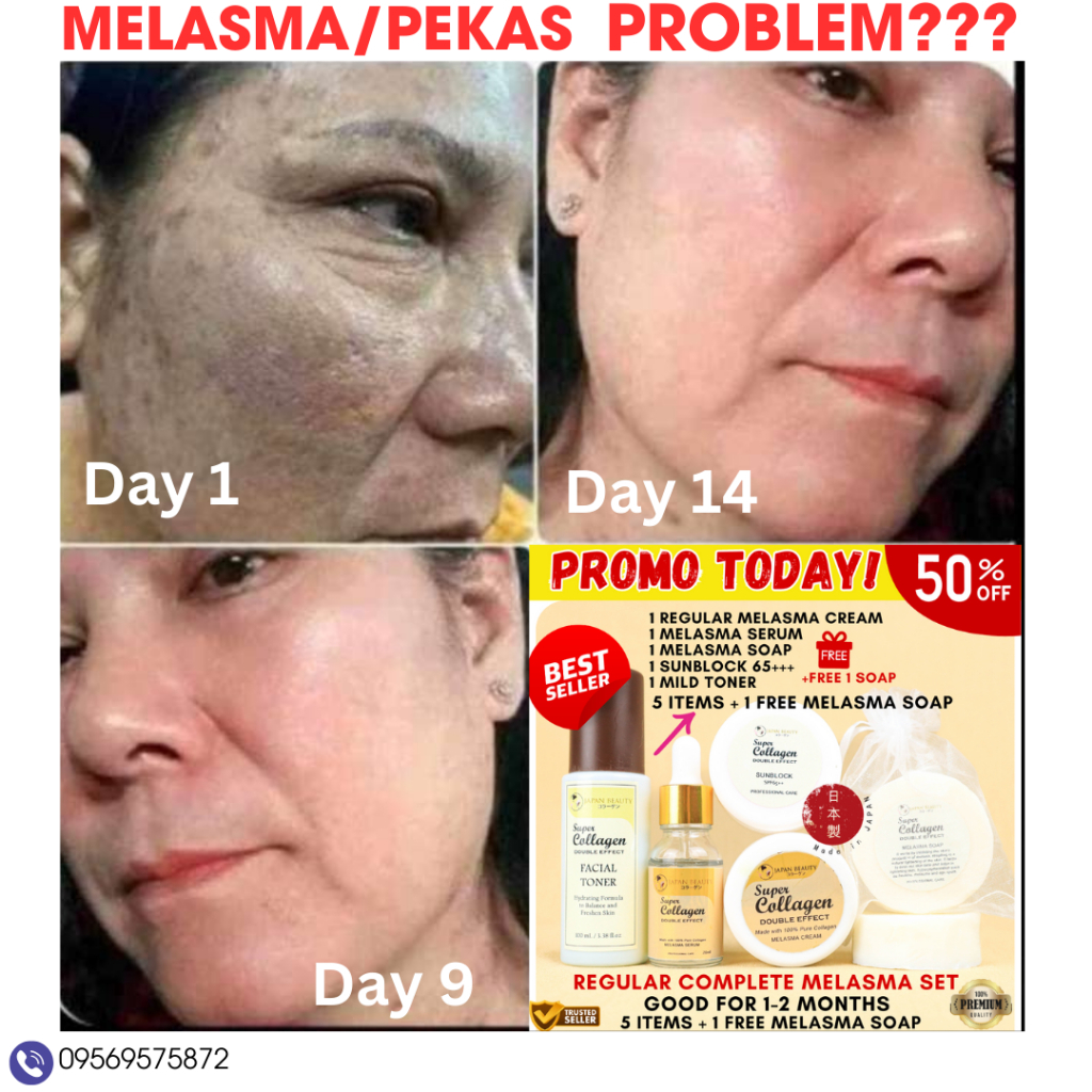 melasma set Collagen japan made | Shopee Philippines