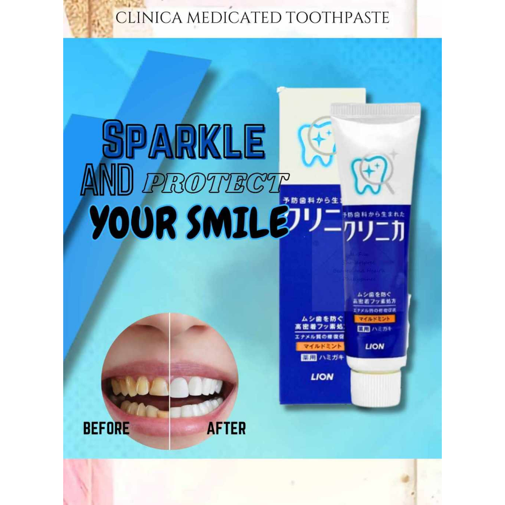 LION Clinica Toothpaste Whitening Mild Mint Flavor 30g | Shopee Philippines