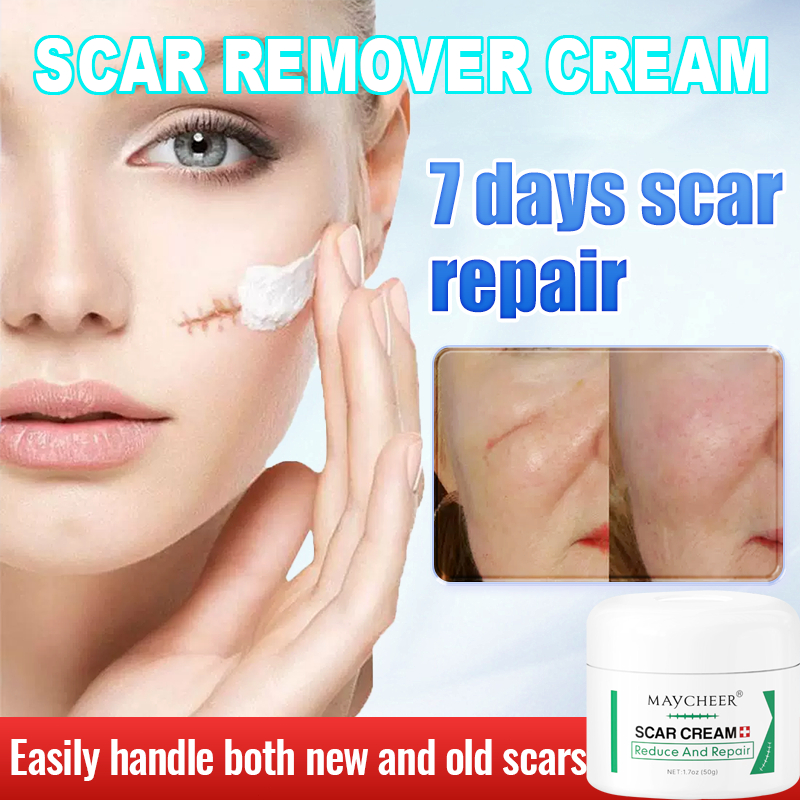 Scar Remover Cream Repair Acne Scar Remover Stretch Mark Scald Burns ...