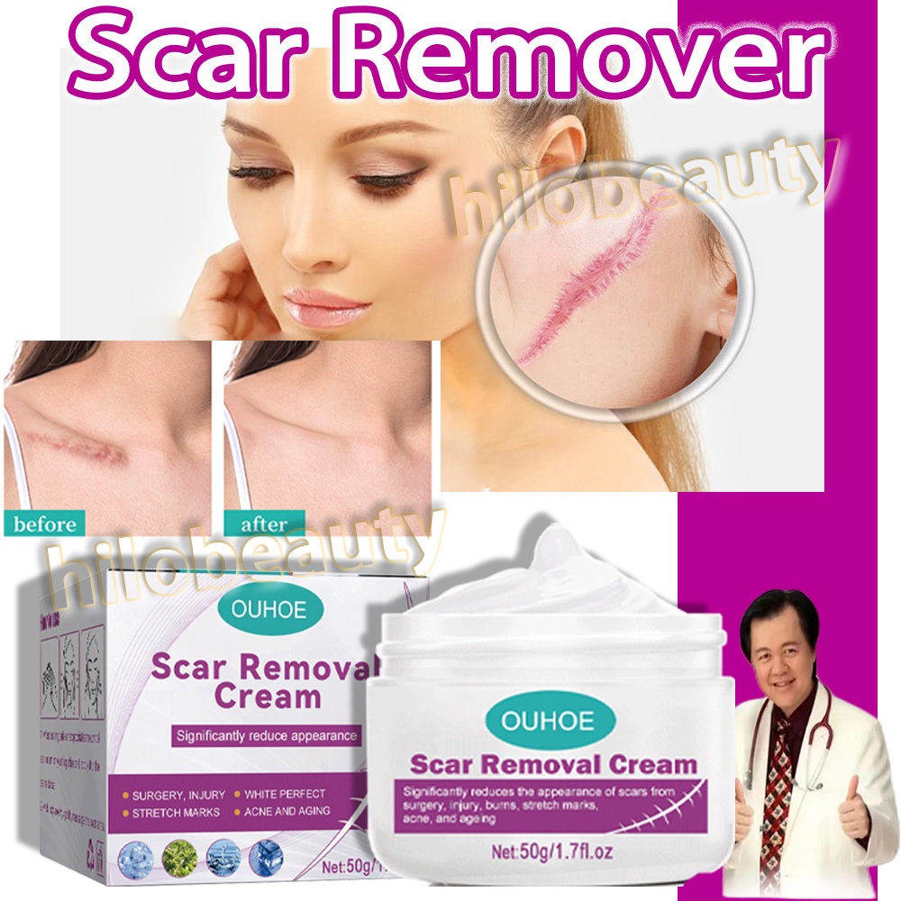 Scar Remover Cream 50g Scar Removal Cream for Old Scar Whitening Acne ...