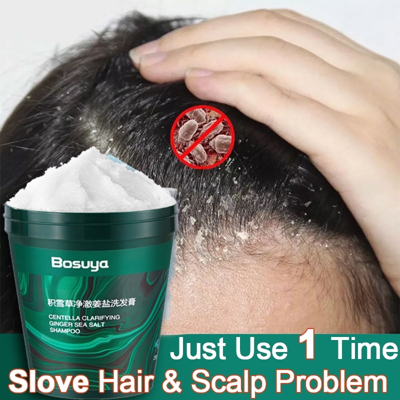 250g Sea Salt Shampoo anti Dandruff Shampoo Dandruff Removal Shampoo ...