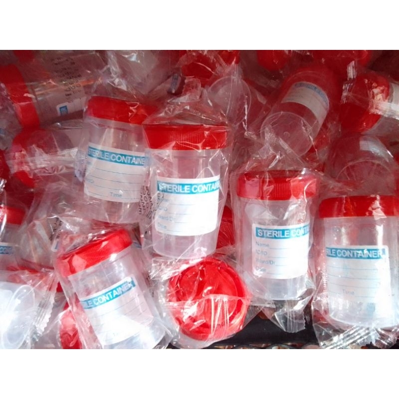 URINE CONTAINER STERILE 60ml | Shopee Philippines