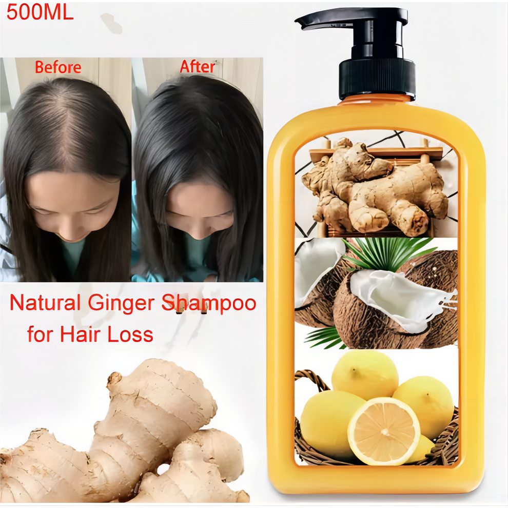 100% Original Ginger Shampoo for Hair Loss Herbal Ginger Extract ...