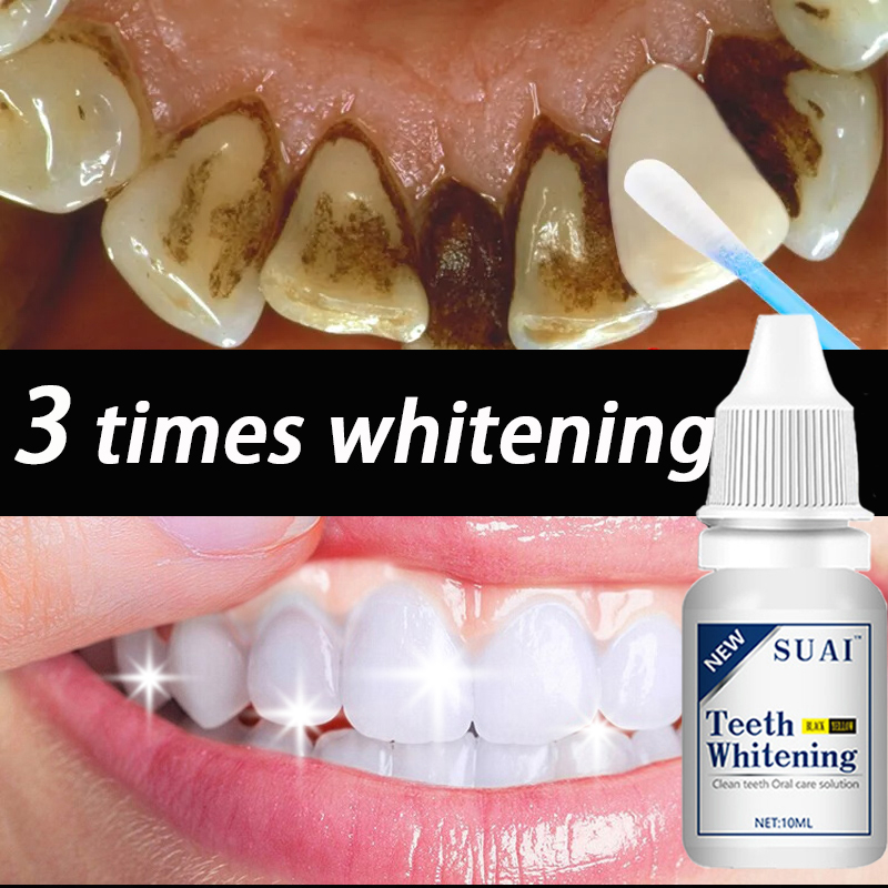 Teeth Whitening Teeth Cleaning Mousse White Teeth Oral Hygiene Tartar ... Teeth Whitening Teeth Cleaning Mousse White Teeth Oral Hygiene Tartar ...