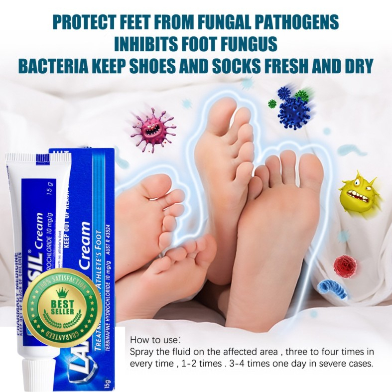 Anti-fungal Cream Athlete's Foot Cream for Beriberi ltching Tinea ...