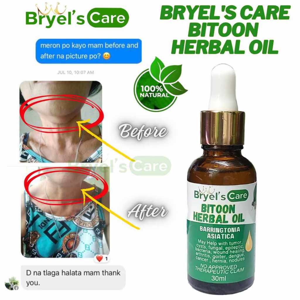 BRYEL'S CARE BITOON HERBAL OIL 30ML NAKAKATULONG PANGTUNAW NG BUKOL BAWAL SA BATA AT SA BUNTIS ...