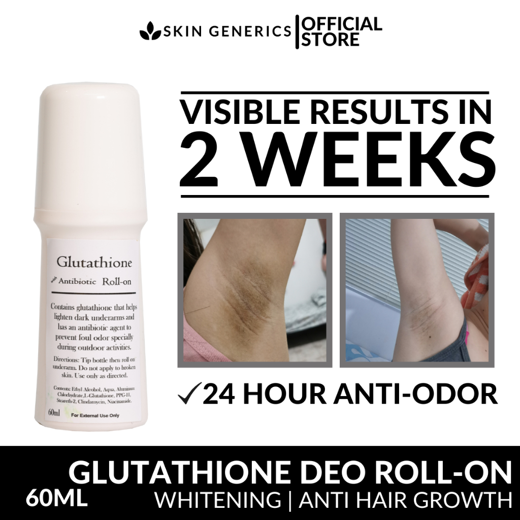 [ 4X WHITENING DEO ROLL-ON ] SkinGenerics DeoWhite Glutathione ...