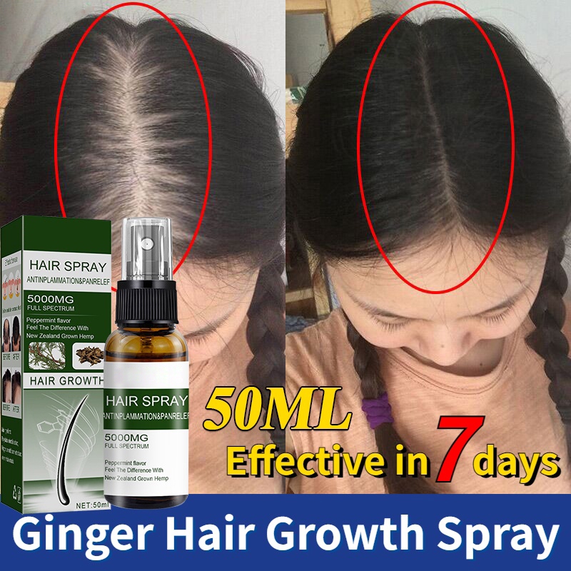 50ML Ginger Hair Grower spray Anti Hair Loss Hair Growth Treatment Hair ...