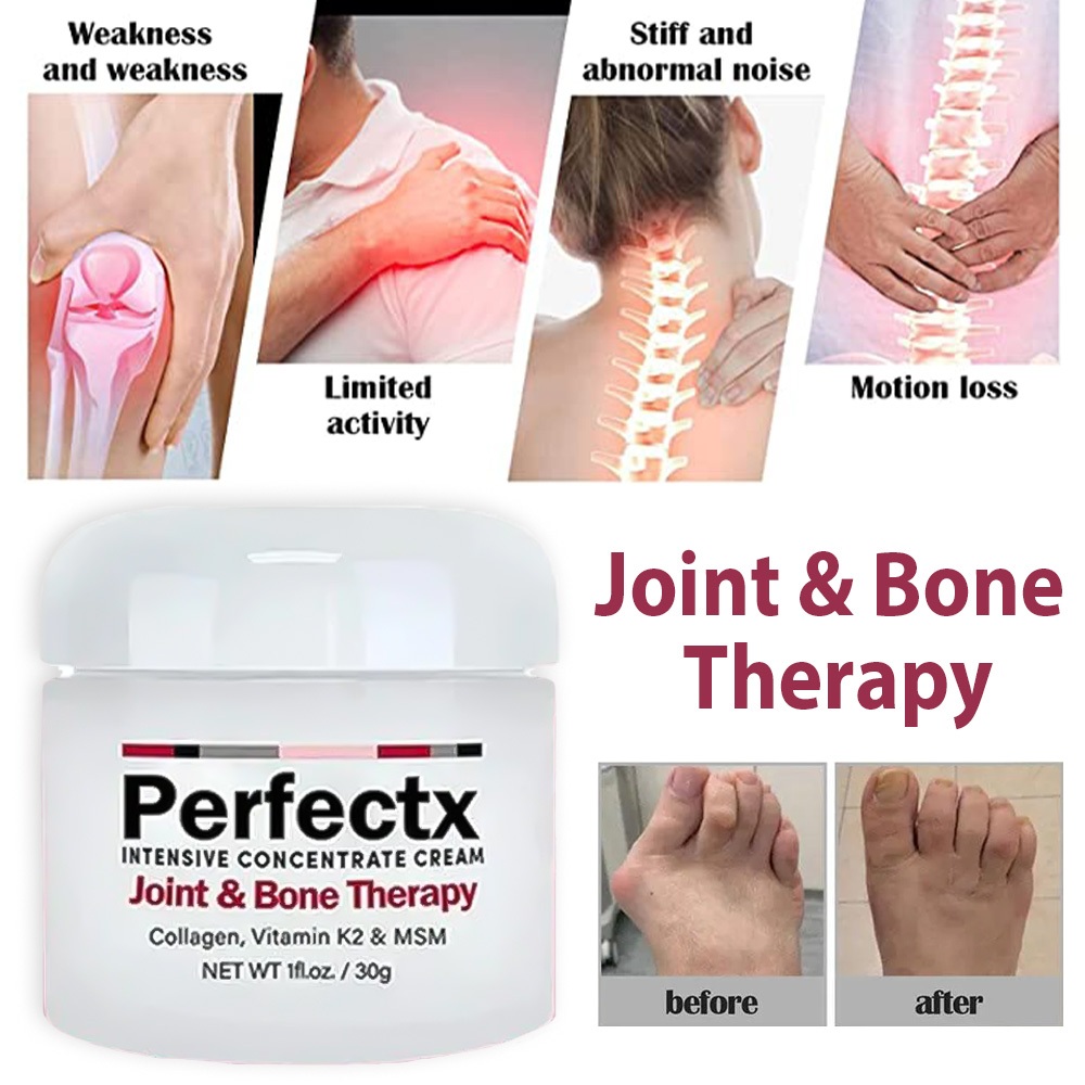 PERFECTX Joint Bone Therapy Cream Joint Knee Pain Toe Bone Pain Relief ...