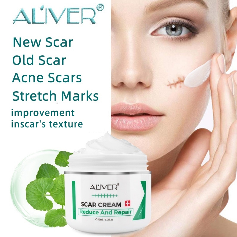 Aliver scar remover Cream stretch mark remover cream scarminator cream ...