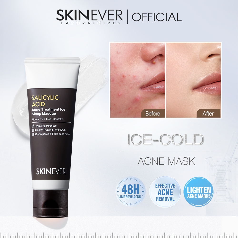 SKINEVER Salicylic Acid Acne Ice Sleeping Leave-On Mask Acne Treatment ...