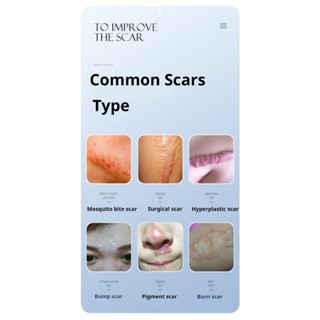 Tiny Bliss KIDS lightens scars scar lightening scar gel for baby scar ...