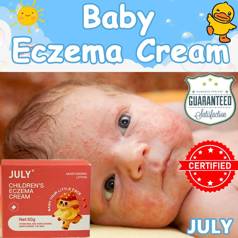 JULY Baby eczema cream Anti-itch Soothing cream Itchy Skin And Allergy ...