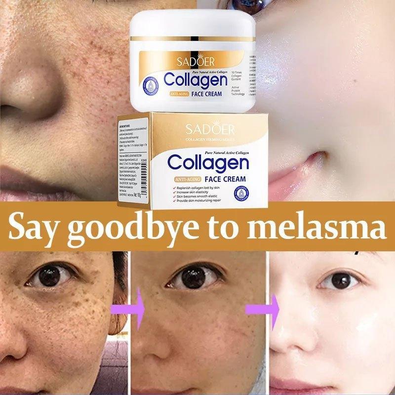 BUY 1 GET 2 100% Effective Collagen Melasma Cream Collagen Face Cream ...