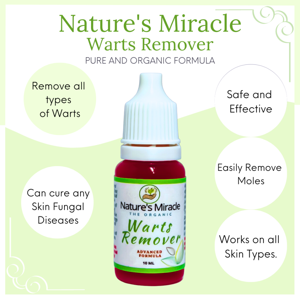 Kasoy Oil Wart and Mole Remover - Organic Kasoy Herbal Oil for Warts ...