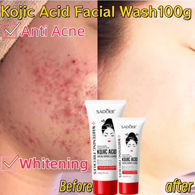 Kojic Acid Facial Wash Whitening Anti Acne Cleanser Remove Melasma Deep ...