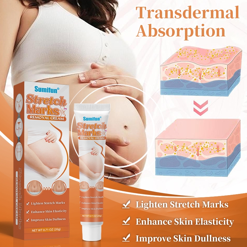 Stretch Marks Remover Cream For Pregnant Scar Repair Lighten Stretch ...