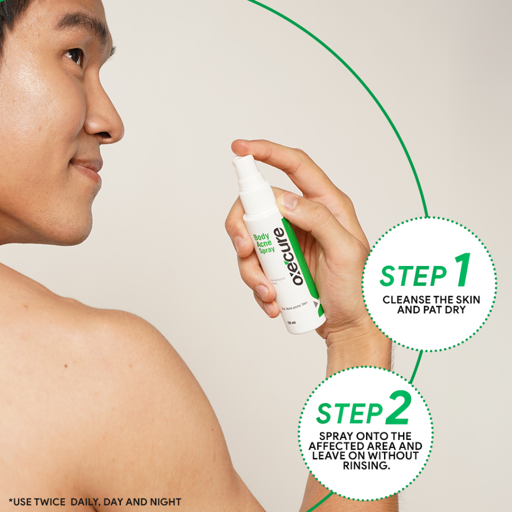 OXECURE 2% Salicylic Acid Body Acne Spray 50ml | Shopee Philippines