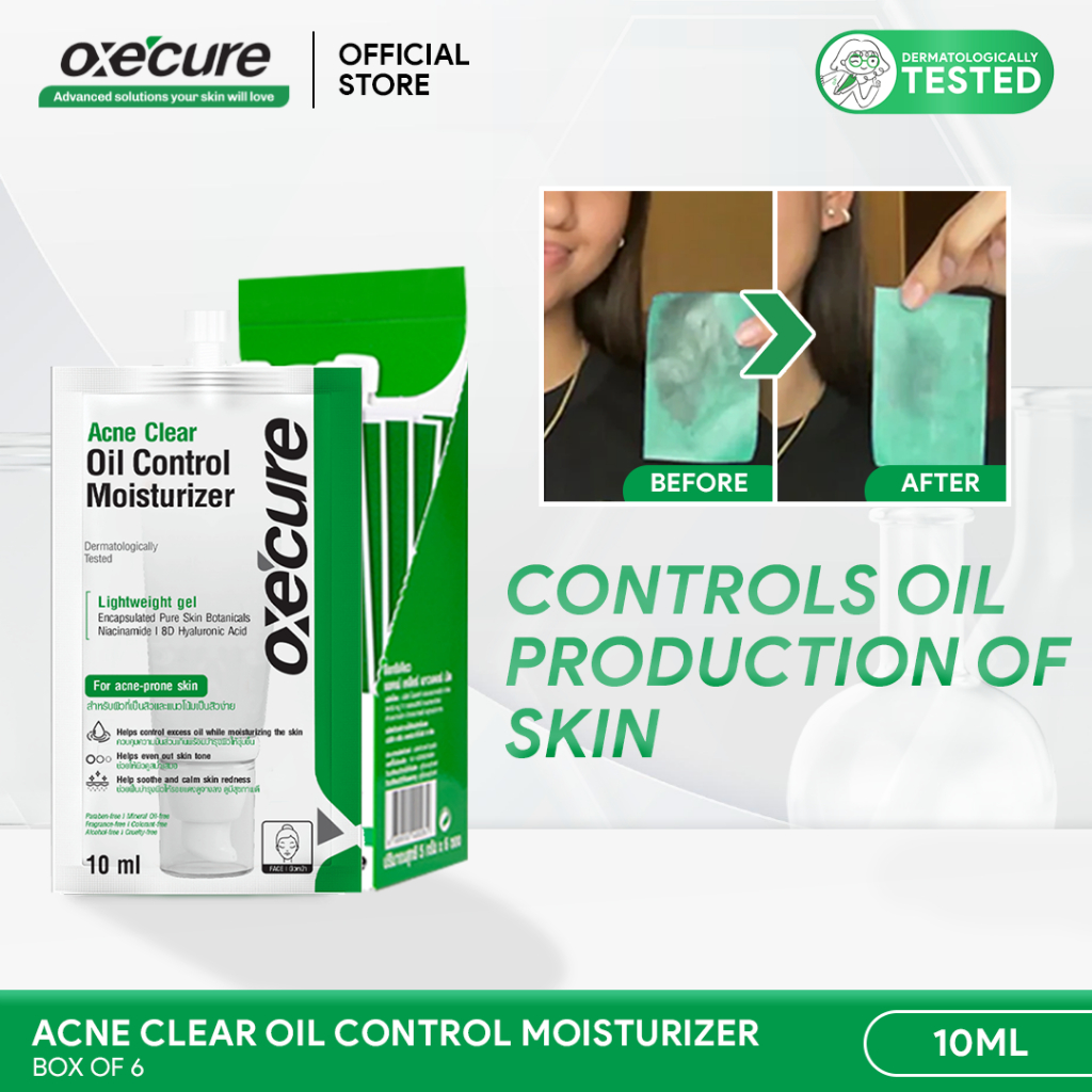 OXECURE Acne Clear Oil Control Moisturizer 10ml Box of 6 | Shopee ...