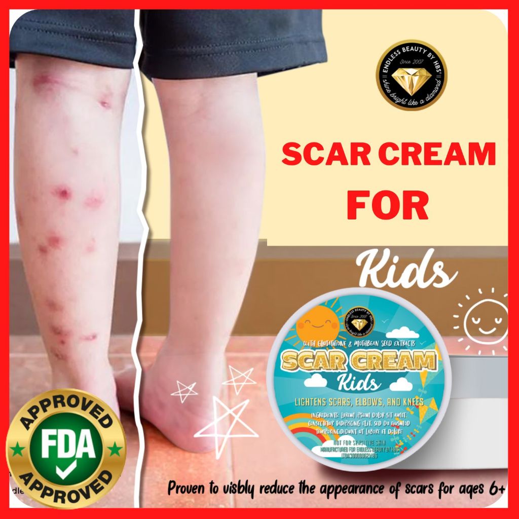 Scar Cream for Kids by Endless Beauty HBS | Shopee Philippines