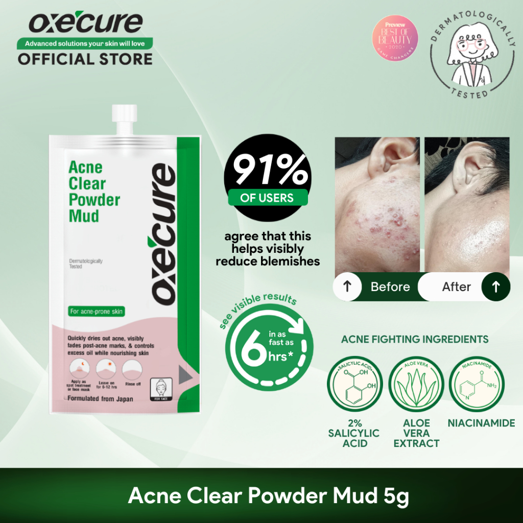 OXECURE 2% Salicylic Acid Acne Clear Powder Mud 5g | Shopee Philippines