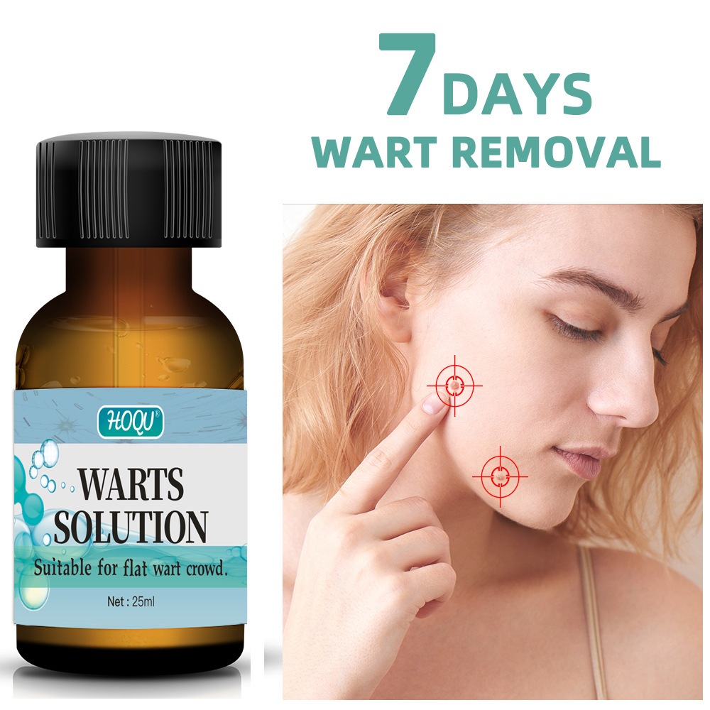 Warts Remover Original Painless Kulugo Remover Solution Skin Tags Mole ...