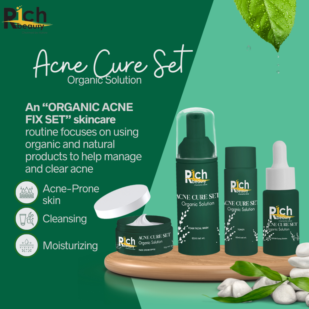 Acne Cure Set ( Organic Sulotion ) | Shopee Philippines