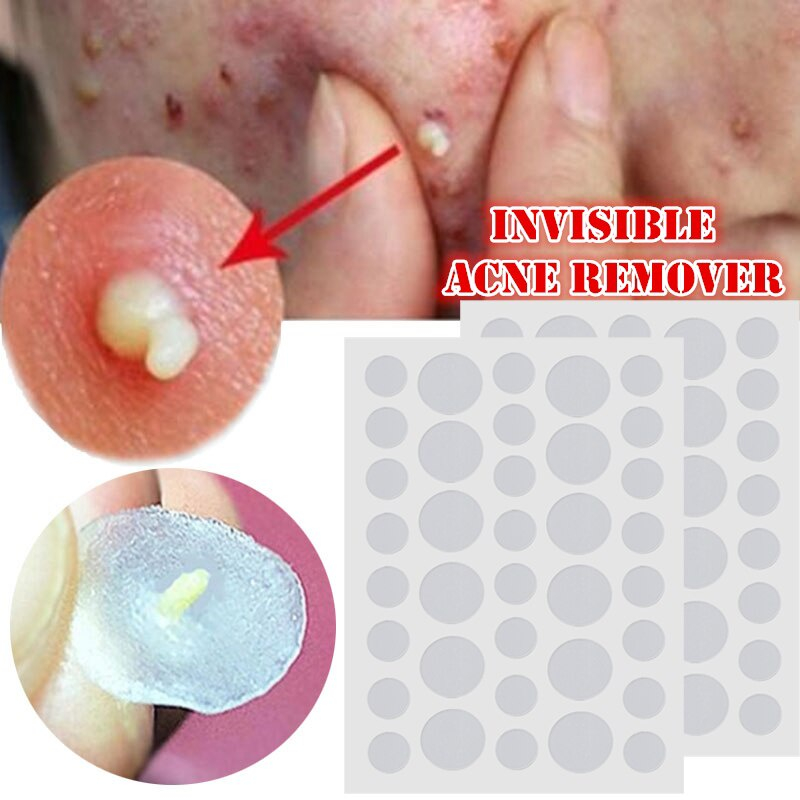 Korea 36 pieces Invisible Acne Patch Pimple Removal Patch Daily Use ...