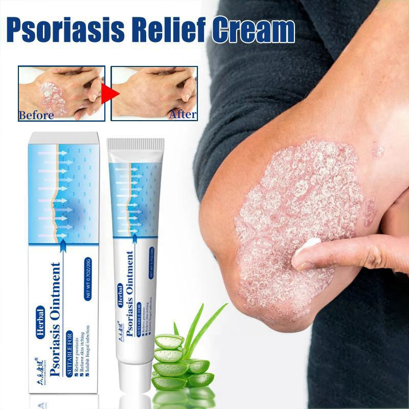 Antibacterial Psoriasis Cream Herbal Treatment Eczema Relief Itch Rash