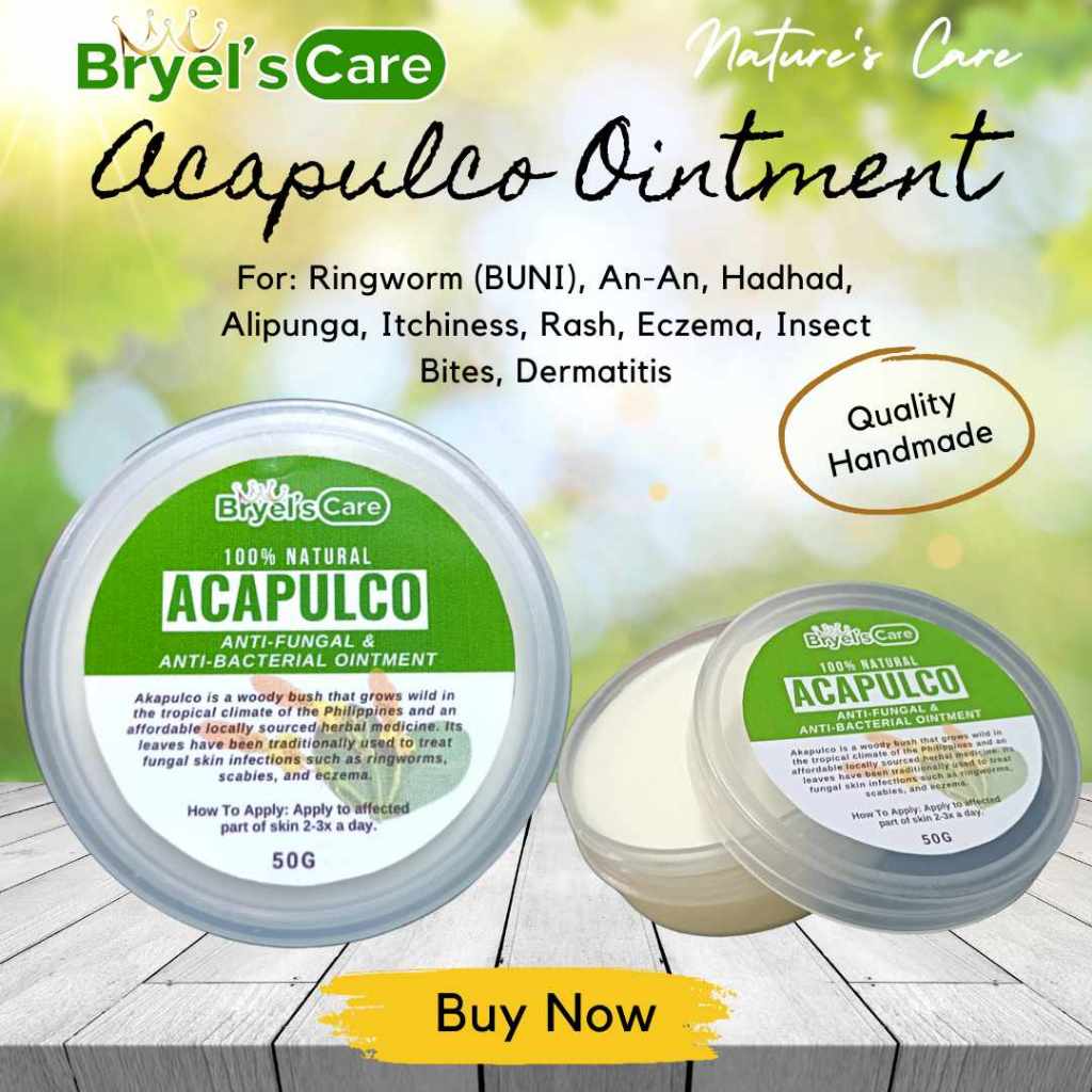 ALL NATURAL ACAPULCO HERBAL OINTMENT 50G ANTI-FUNGAL& ANTI-BACTERIAL ...