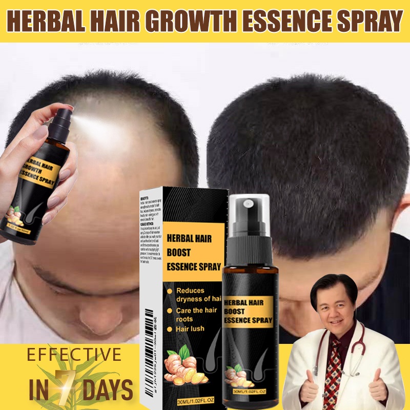 Hair Grower Spray Minoxidil Hair Growth Anti Hairfall Beard Hair Boost