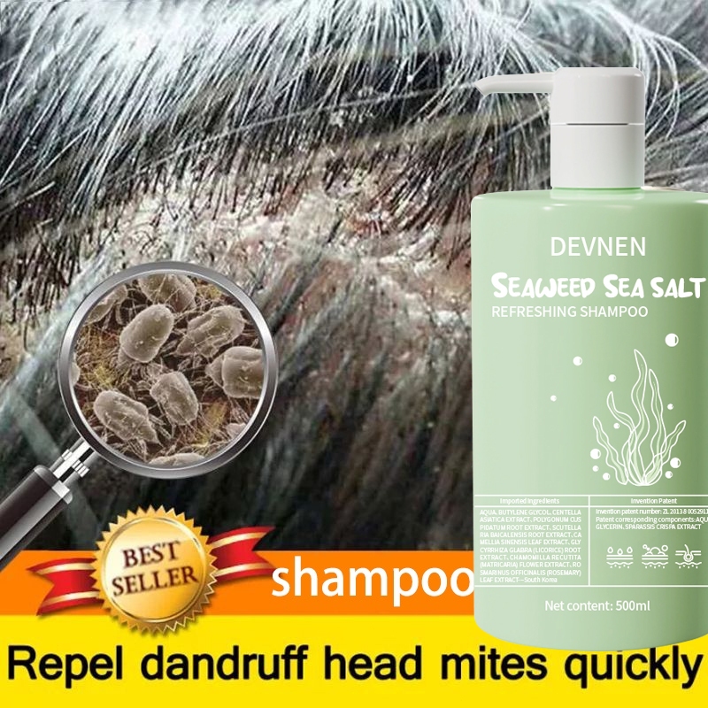 DEVNEN Sea Salt Anti Dandruff Shampoo For Scalp Itching Hair Treatment ...
