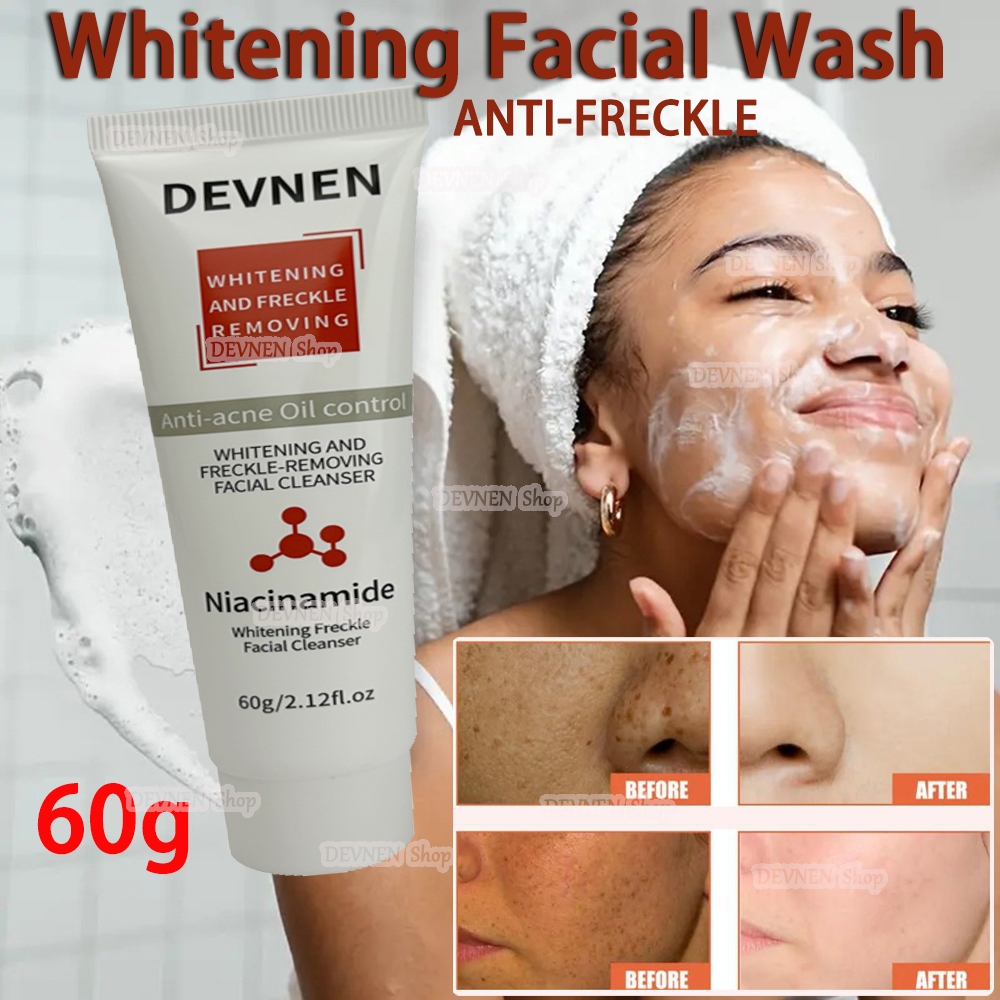 DEVNEN Whitening Facial Wash Freckle Cleanser Remove Dark Spots ...