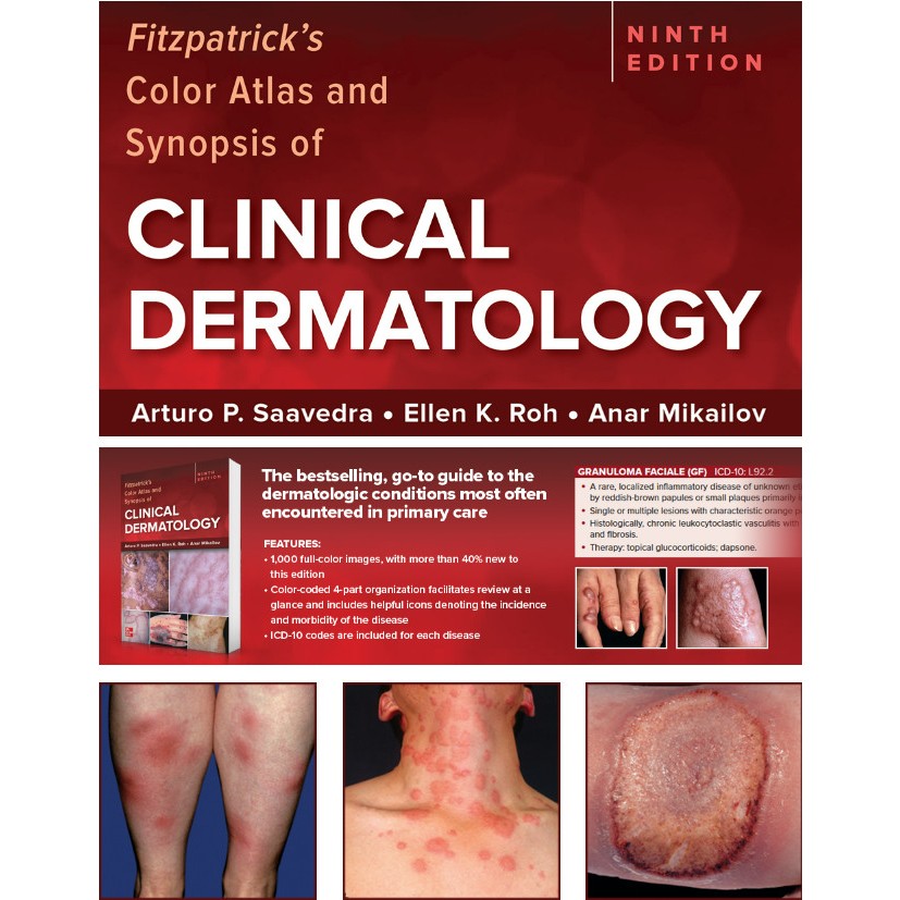 Fitzpatrick's Color Atlas and Synopsis of Clinical Dermatology 9th Edition | Shopee Philippines