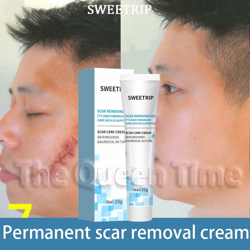 SWEETRIP Scar Removal Cream Old Scar Pimple Mark Stretch Mark peklat ...