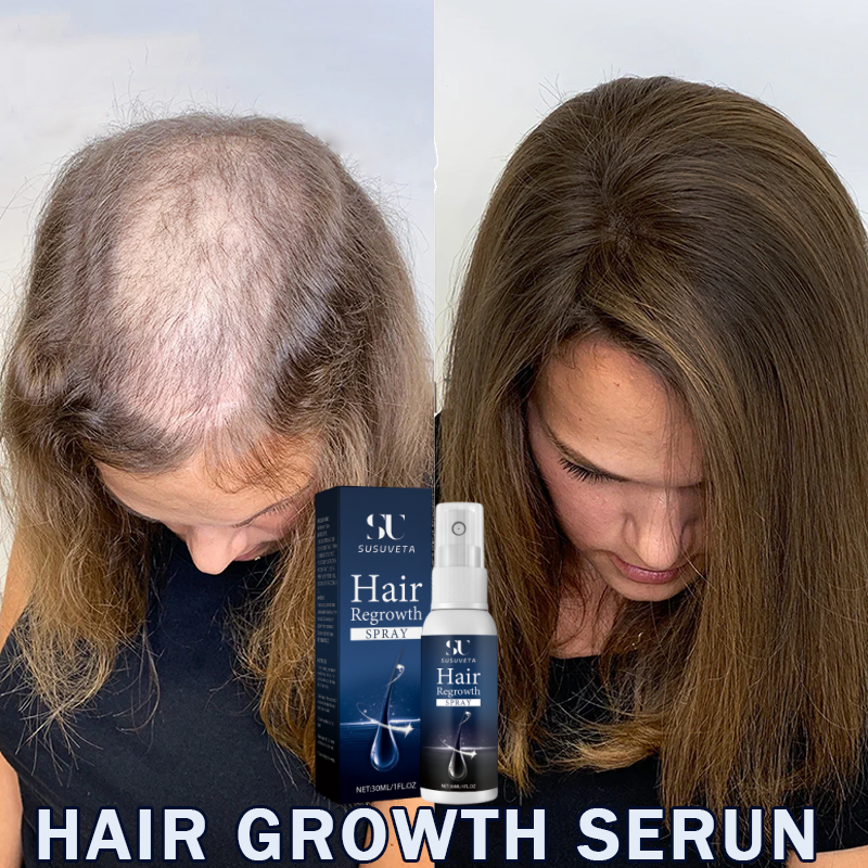 Hair growth serum hair grower for men hair thickener and grower hair ...
