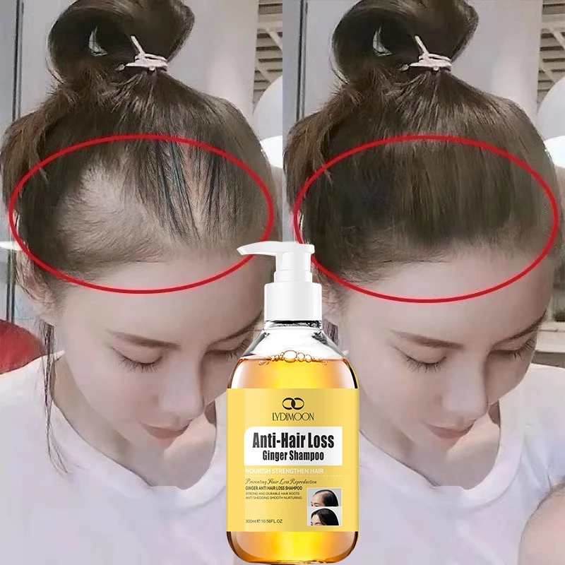 Ginger shampoo original Shampoo for hair growth faster 500ml Anti ...