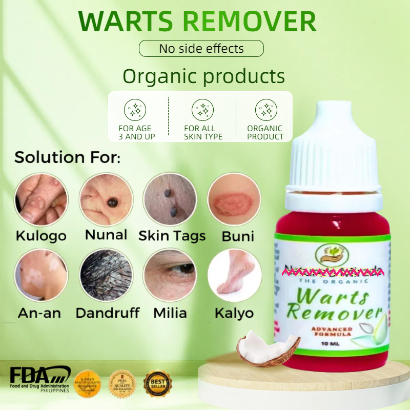 Warts remover kasoy oil Natural Cashew Oil No side effects kulugo ...