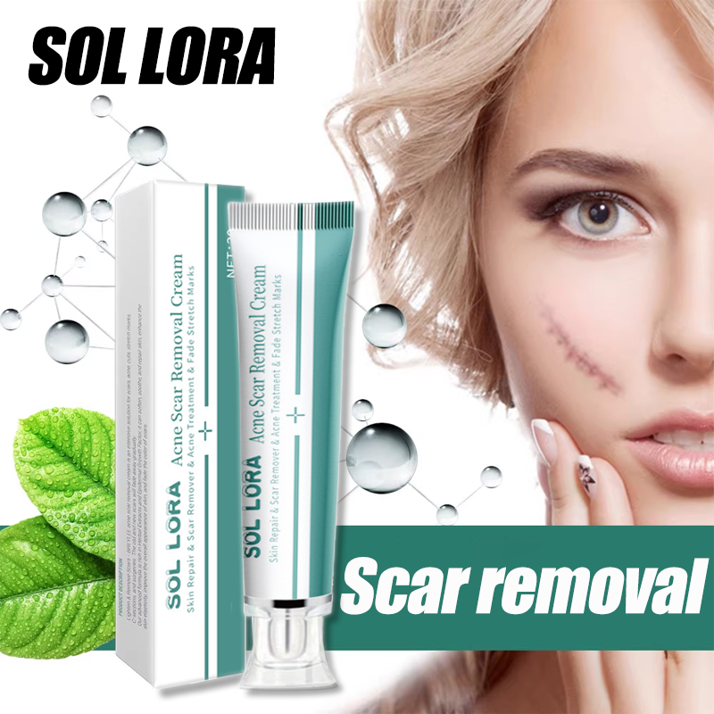 SOL LORA 30g pimple remover cream acne scars removal for face ...