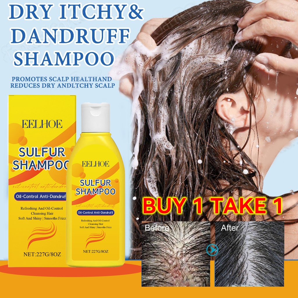 Sulfur Shampoo Mite Removal Anti-Dandruff With Gentle Fresh And Non ...
