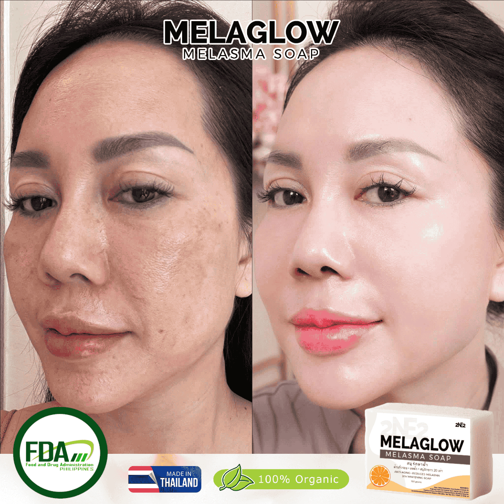 2NE2 Thailand MelaGlow Melasma Soap - Melasma, Pekas, Hyperpigmentation ...