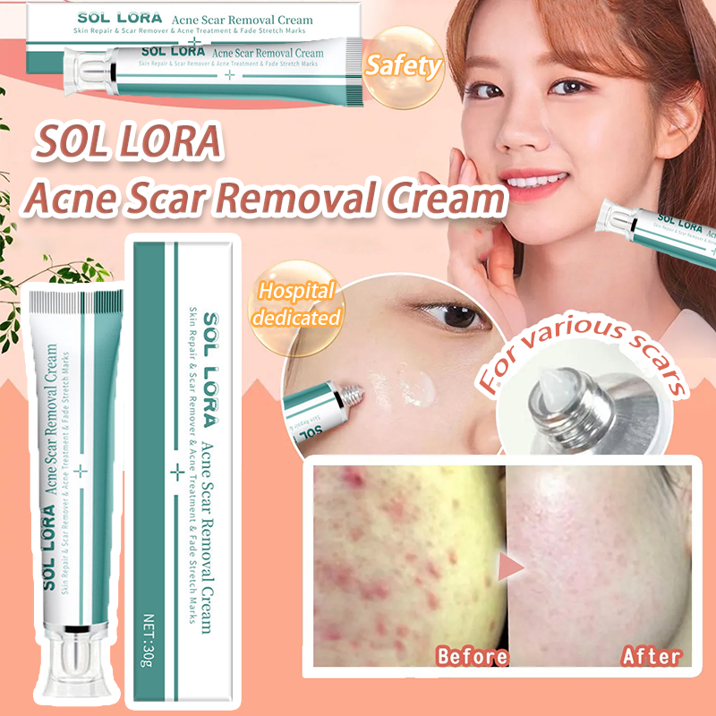 Universal scar removal cream Remove scars without leaving any traces ...