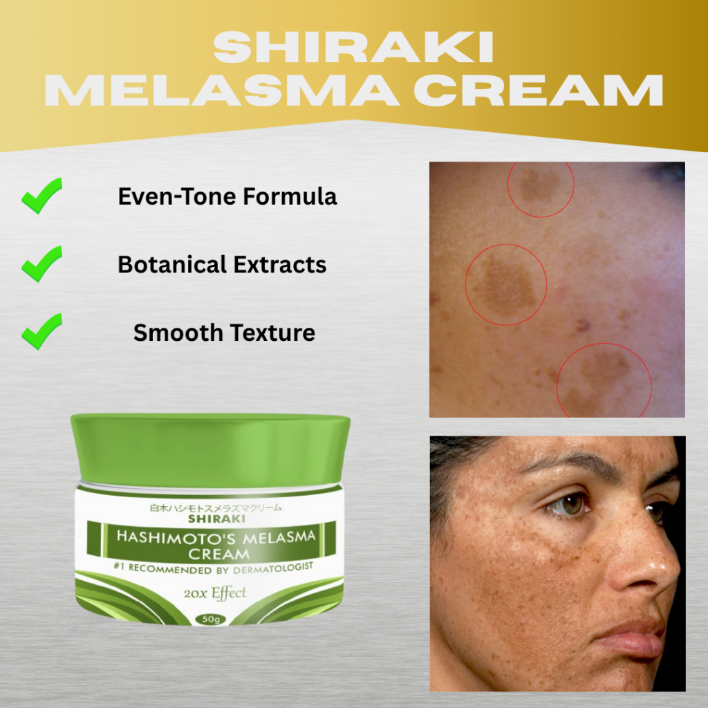 Shiraki Melasma Cream 50g – Gentle Facial Cream for Smooth, Even ...