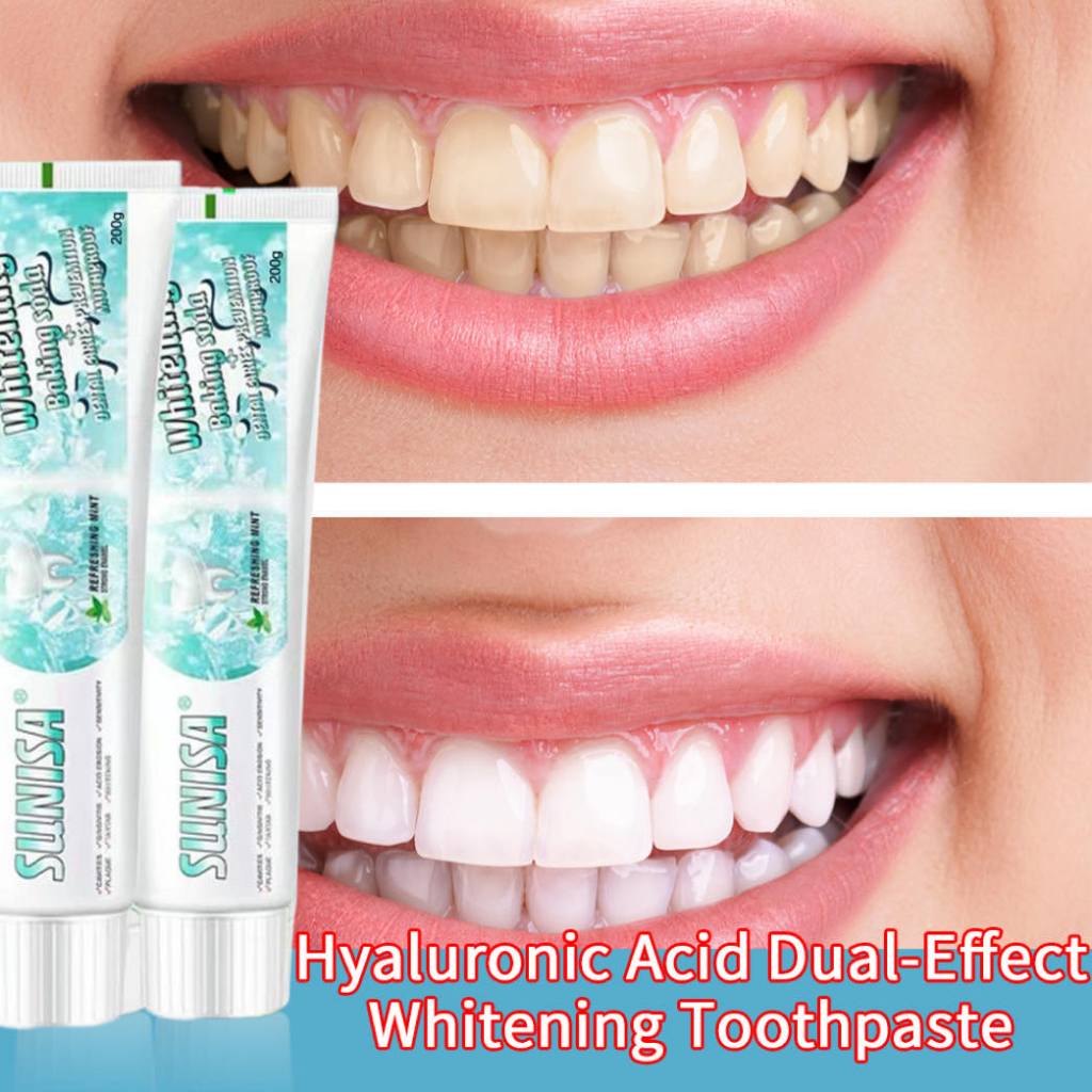 『BUY 1 TAKE 1』JAPAN Whitening Toothpaste Acid Dual-Effect Fresh Breath ...