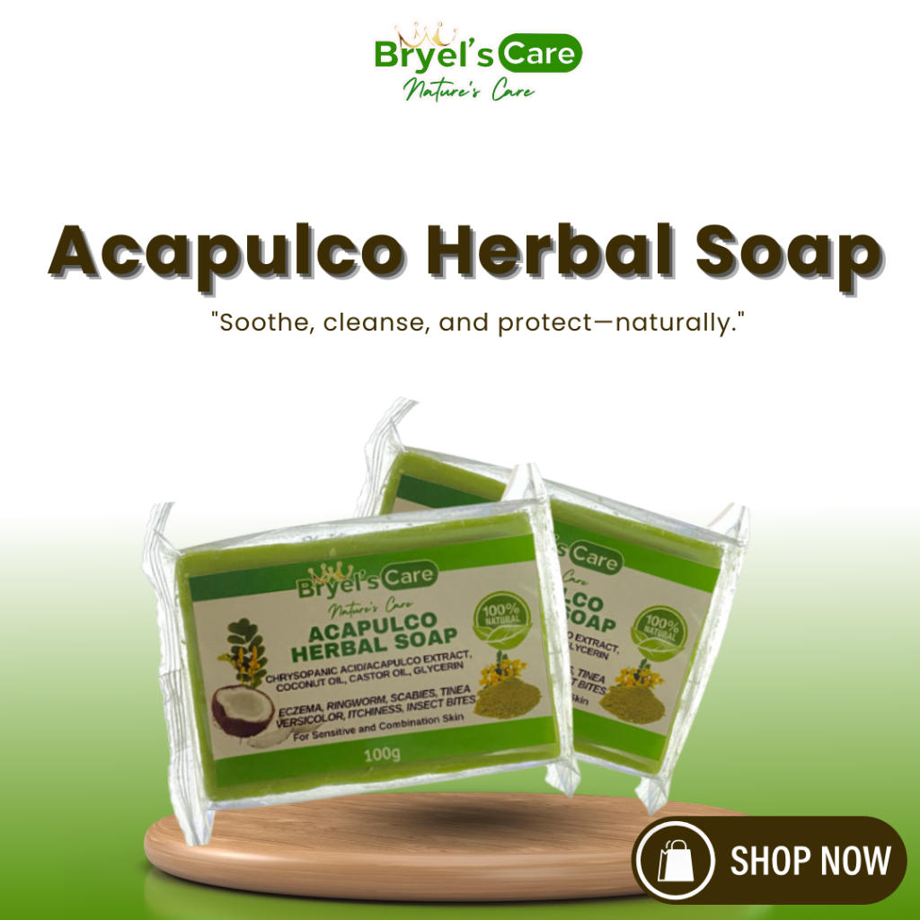 Acapulco Herbal Soap 100g Anti Fungal Body Soap(Itchiness,Eczema,Tinea ...