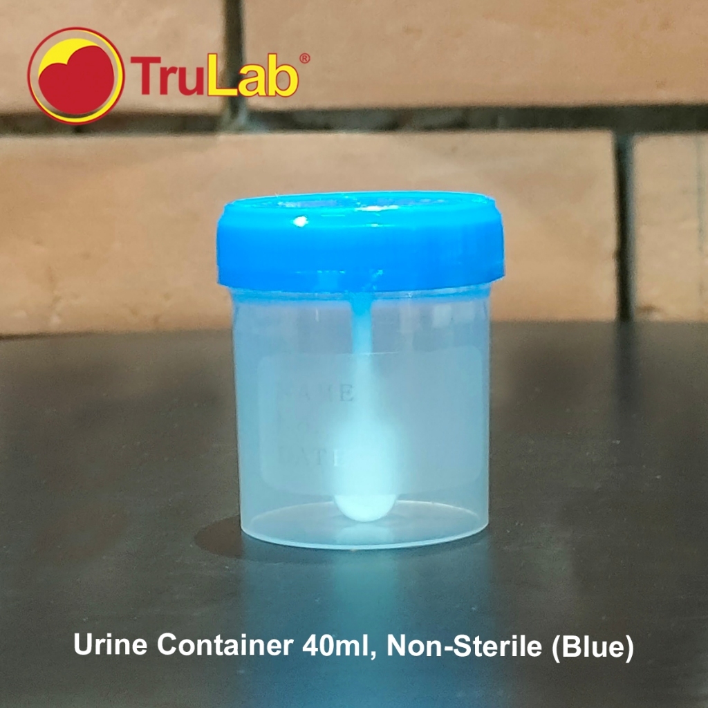 Stool Specimen Container 40ml 100pcs Unsterile with Spoon Trulab ...