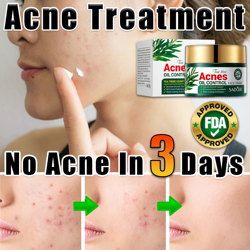 Pimple Remover 100% Effectively Eliminate All Kinds Of Stubborn Acne ...