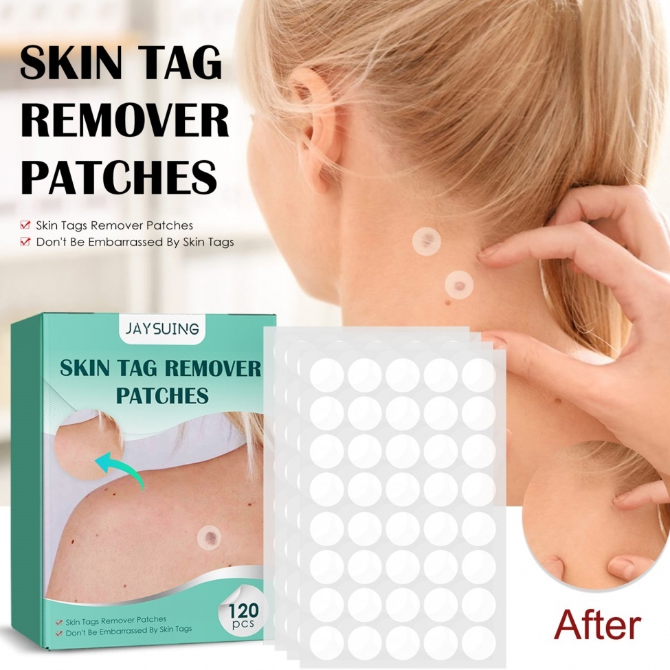 Skin Tag Removal Sticker Warts Removal Patches Relieve Pressure ...