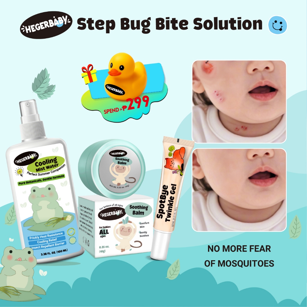 Hegerbaby Prickly Heat Cooling Mist Water + Soothing Balm + Scar Gel ...